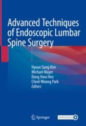 Full Endoscopic Paraspinal Approach for Lumbar Foraminal Stenosis ...