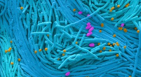 Human Microbiome Project, part 2