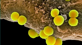 Research Highlights | Nature