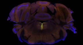 Browse Articles | Nature