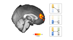 Neuroscience - Latest research and news | Nature