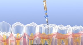 Evidence-Based Dentistry