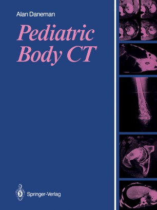 Pediatric Body CT | SpringerLink