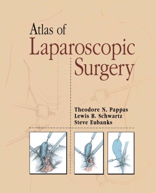 Atlas of Laparoscopic Surgery | SpringerLink