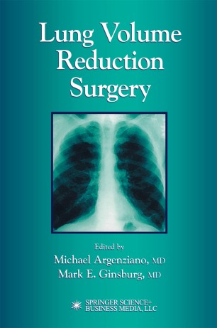 Lung Volume Reduction Surgery | SpringerLink