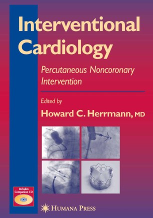Interventional Cardiology | SpringerLink
