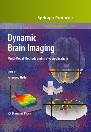 Dynamic Brain Imaging | SpringerLink