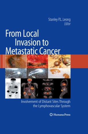 From Local Invasion to Metastatic Cancer | SpringerLink