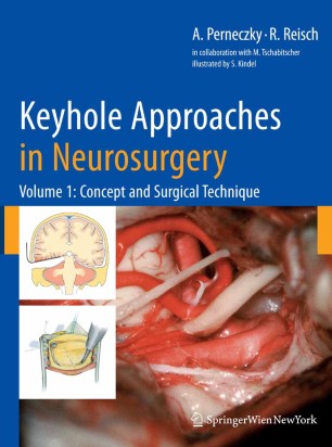 Keyhole Approaches in Neurosurgery | SpringerLink