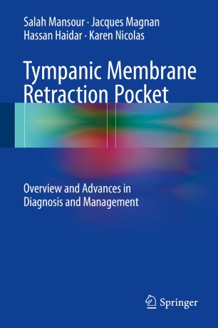Tympanic Membrane Retraction Pocket | SpringerLink
