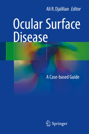 Ocular Surface Disease | SpringerLink