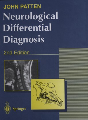 Neurological Differential Diagnosis | SpringerLink