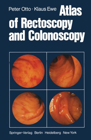 Atlas of Rectoscopy and Coloscopy | SpringerLink