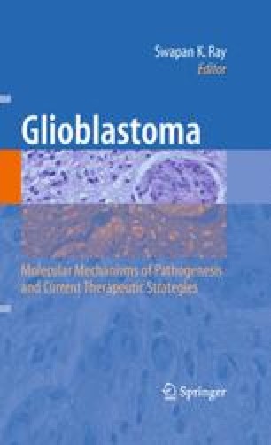 Pathology of Glioblastoma Multiforme | SpringerLink