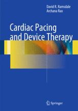 Precautions After Permanent Pacemaker Implantation | SpringerLink