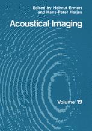 Optimization of Dynamic Receive Focusing in Ultrasound Imaging ...