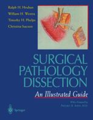 General Approach to Surgical Pathology Specimens | SpringerLink