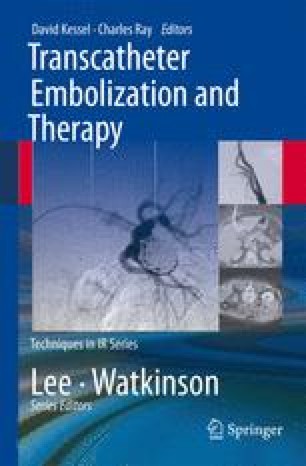 Management of Post-embolization Syndrome | SpringerLink