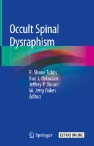 Cutaneous Stigmata and the Occult Spinal Dysraphisms | SpringerLink
