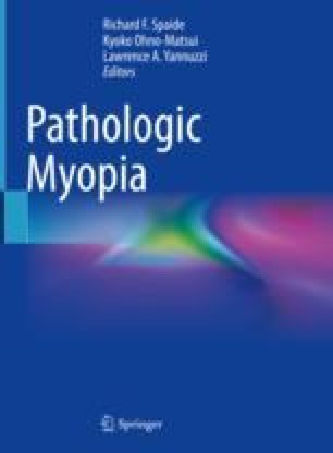 Epidemiology of Myopia, High Myopia, and Pathological Myopia | SpringerLink
