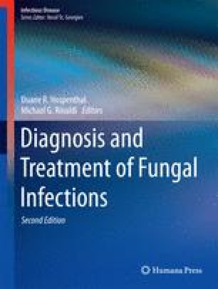 Approach to Patients with Suspected Fungal Infections | SpringerLink