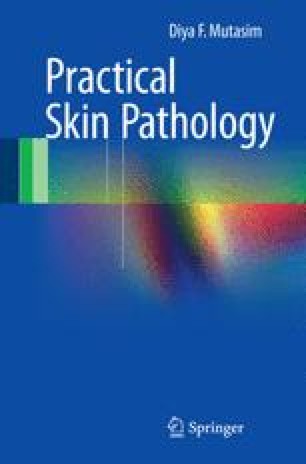 What Is Psoriasiform Dermatitis? | SpringerLink