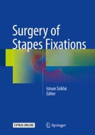 Congenital Stapes Fixation | SpringerLink