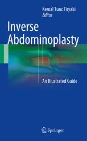 Prevention and Management of Abdominoplasty Complications | SpringerLink