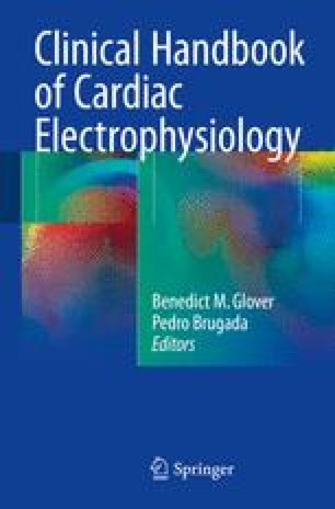 Cardiac Electrophysiology Study, Diagnostic Maneuvers and Ablation ...