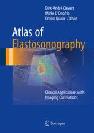 Elastography of the Breast | SpringerLink
