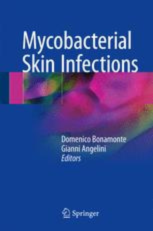 Mycobacterium scrofulaceum Infection | SpringerLink