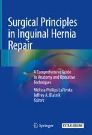 Preperitoneal (Stoppa) Open Inguinal Hernia Repair | SpringerLink
