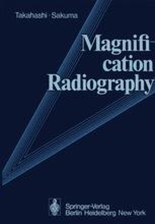 Principles of Magnification Radiography | SpringerLink