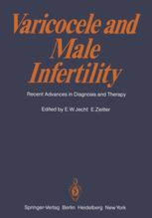 Diagnosis and Differential Diagnosis of Varicocele by Ultrasound ...