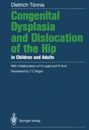 Nomenclature and Classification of Congenital Hip Dislocation ...