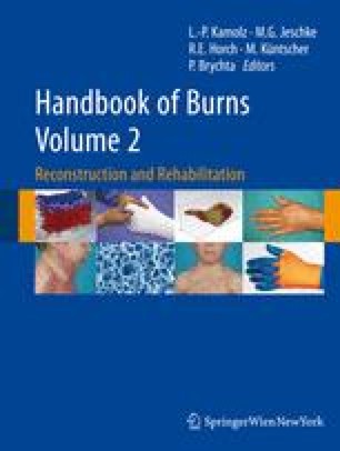 Burn wound healing: Pathophysiology | SpringerLink