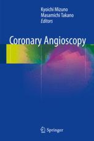 Acute Coronary Syndrome vs. Stable Angina Pectoris: Angioscopic Point ...