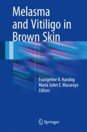Differential Diagnosis of Vitiligo in Brown Skin | SpringerLink
