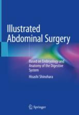 Surgical Repair of Rectal Prolapse: The Altemeier Procedure | SpringerLink