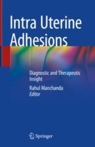 Role of Hysterosalpingography (HSG) and Sono-HSG | SpringerLink