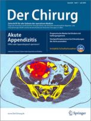 Laparoskopische Appendektomie | SpringerLink