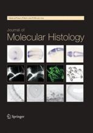 The tidemark of the chondro-osseous junction of the normal human knee ...