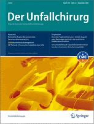 Fixationsprinzipien des zementlosen modularen Hüftrevisionsschaftes ...