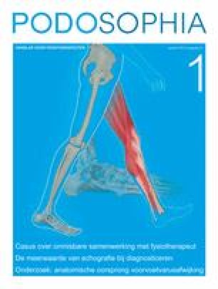 Mulders sign test | SpringerLink