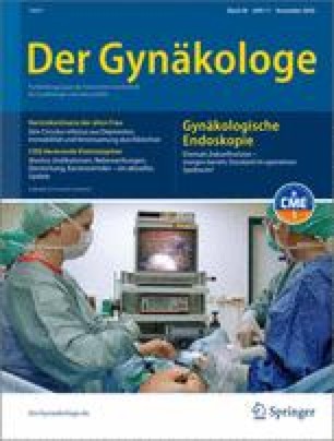 Laparoskopische suprazervikale Hysterektomie (LASH) | SpringerLink