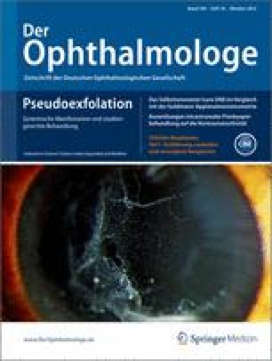 Pseudoexfoliationssyndrom/Glaukom | SpringerLink