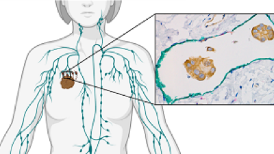 Journal of Mammary Gland Biology and Neoplasia | Home