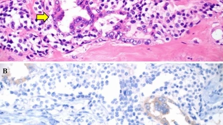 Home | Endocrine Pathology