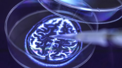 Organoids and organ-on-a-chip systems