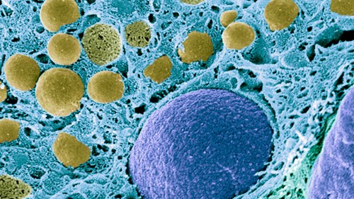 Editor's choice: diabetes